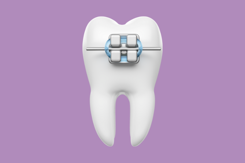 6th Tooth